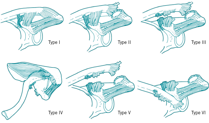 Acromioclavicular joint (AC)